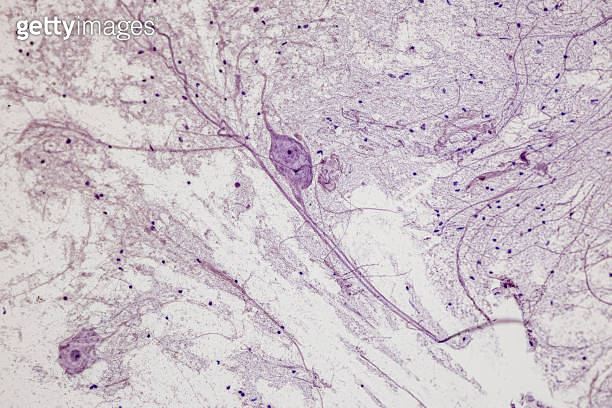 Motor Neuron, Spinal cord, Nerve fibres and nerve cells under the ...