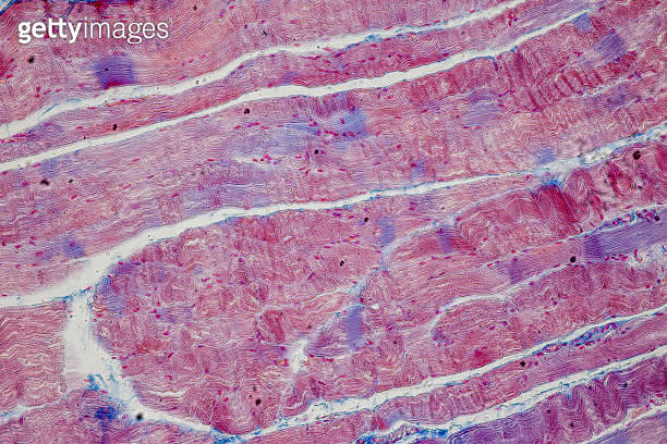 Adipose tissue human, Smooth muscles human, Bone human and Striated ...