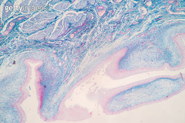 Micrograph of the Urinary bladder human under the microscope for ...