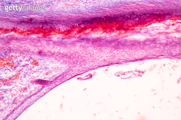 Tissue of Skin from finger Human and Nail development finger of Human ...
