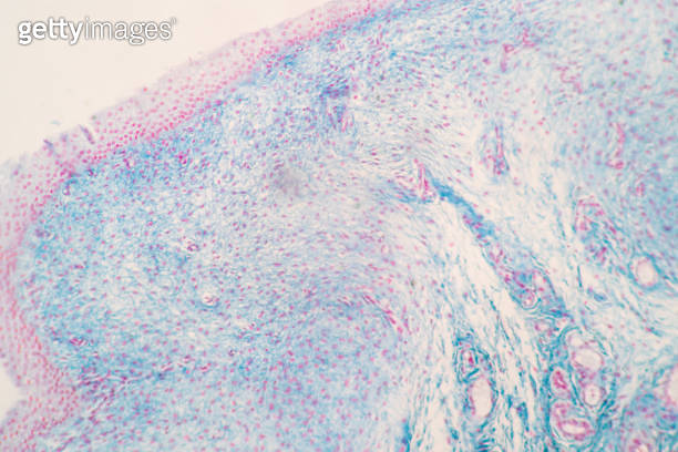 Micrograph of the Urinary bladder human under the microscope for ...