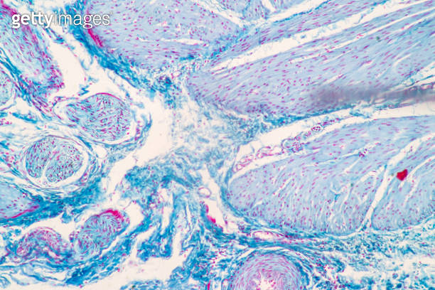 Micrograph of the Urinary bladder human under the microscope for ...