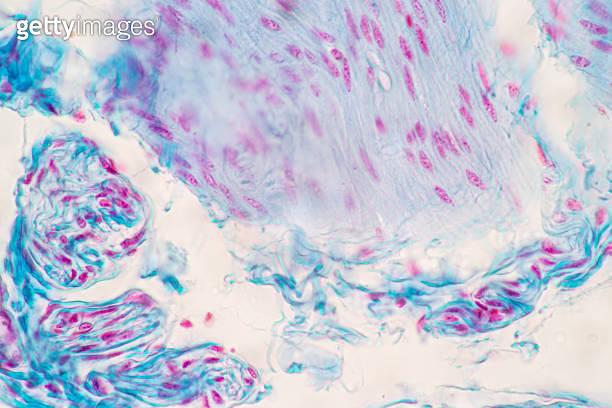 Micrograph of the Urinary bladder human under the microscope for ...