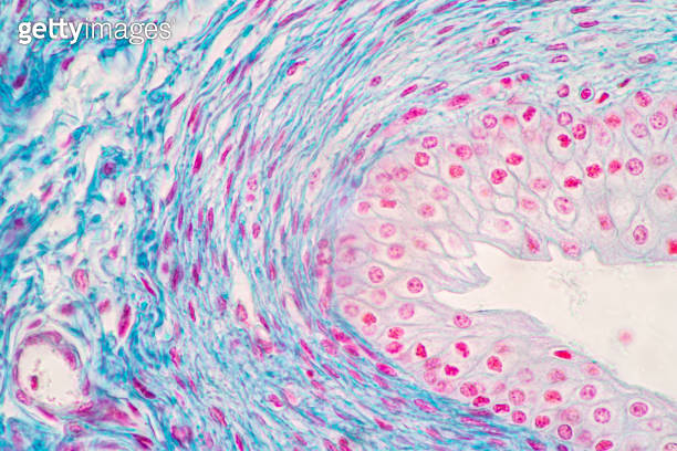 Micrograph of the Urinary bladder human under the microscope for ...