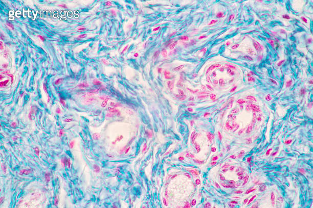 Micrograph of the Urinary bladder human under the microscope for ...