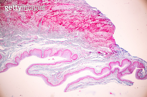 Characteristics Tissue of Vagina Human under the microscope. 이미지 ...