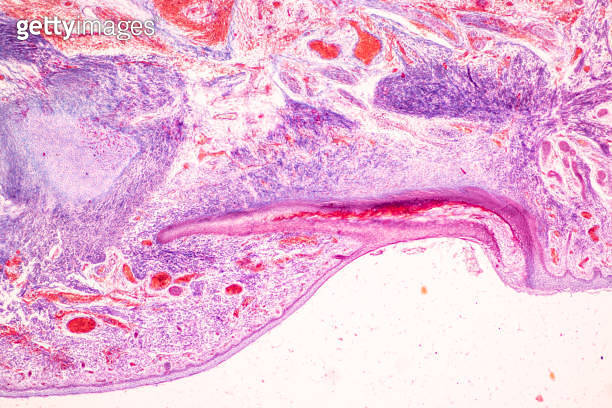 Tissue of Skin from finger Human and Nail development finger of Human ...
