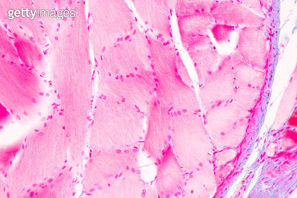 Histological Rectum human, Gall bladder human and Urethra Human under ...