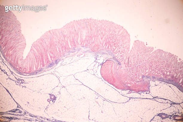 Histological Rectum human, Gall bladder human and Urethra Human under ...