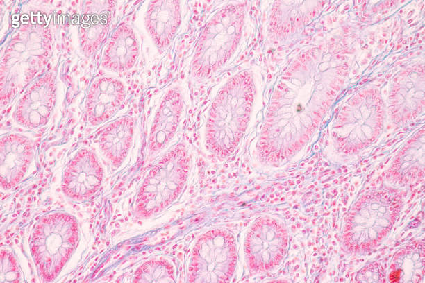 Histological Rectum human, Gall bladder human and Urethra Human under ...