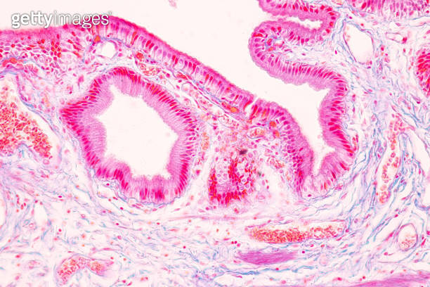 Histological Rectum human, Gall bladder human and Urethra Human under ...