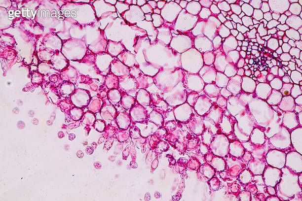 Host cells with spores (mold) are inside wood under the microscope. 이미지 ...