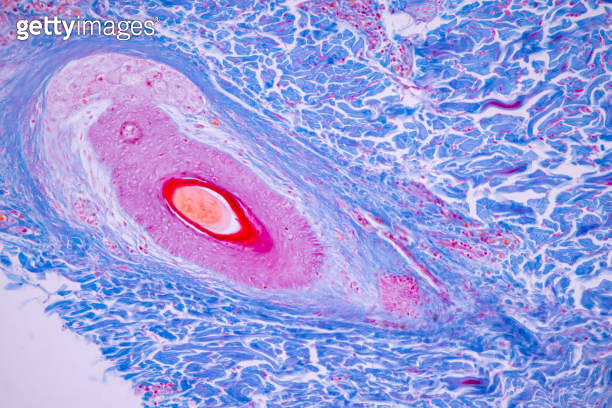 Characteristics Tissue of Human scalp, Skin human from general body ...