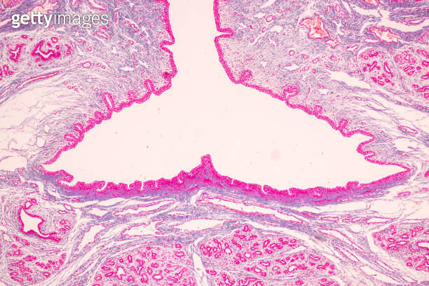 Histological Rectum human, Gall bladder human and Urethra Human under ...