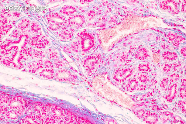 Histological Rectum human, Gall bladder human and Urethra Human under ...