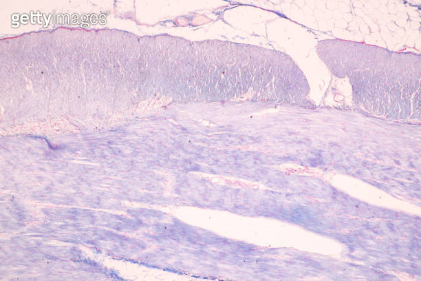 Histological Rectum human, Gall bladder human and Urethra Human under ...