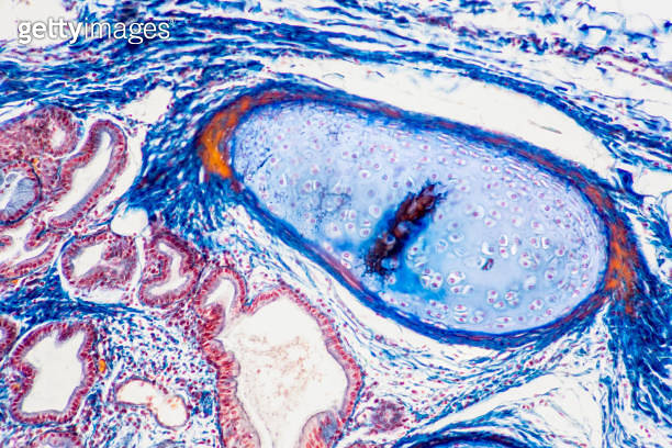 Human lung pathology under light microscope, The lungs is organs of the ...