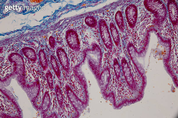 Type of Tissue Human under the microscope in Lab. 이미지 (1769847278) - 게티 ...