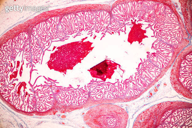 Histological Spermatic cord human, Seminal vesicle human, Prostate ...