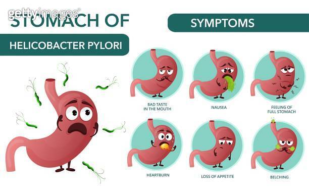 Symptoms helicobacter pylori infographic with cartoon stomach characters 이미지 (1675668489) - 게티이미지뱅크