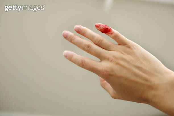 Female hand with red blood, little finger is bleeding profusely. Woman ...