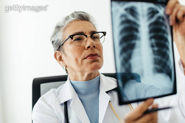 Careful examination: Doctor looks at an x-ray scan of the lungs 이미지 ...