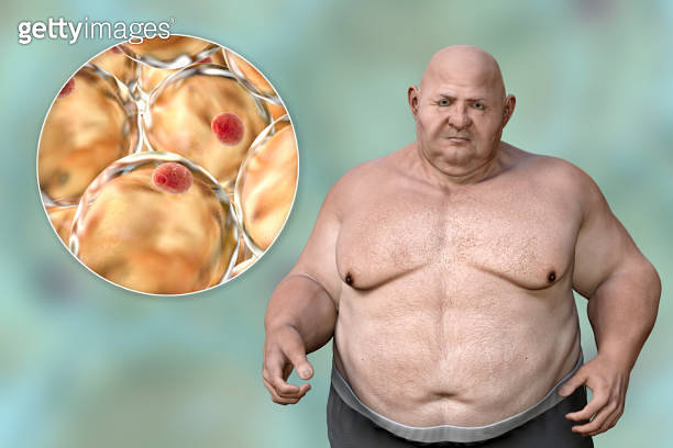 Obese man and close-up view of fat cells, 3D illustration. Concept of ...