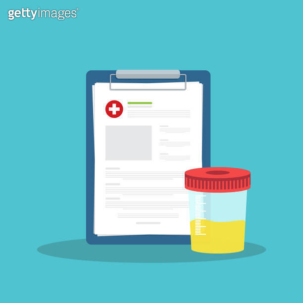 Urine analysis. Urine test icon. Pee sample in a plastic box and ...