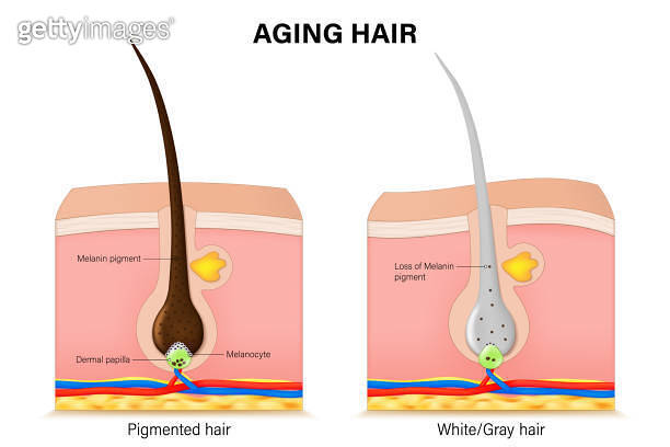 Aging hair. Pigmented and gray hair. Due to increasing age Hair becomes ...