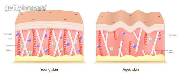 Aging skin. Comparison of young and aged skin. Facial skin problems ...