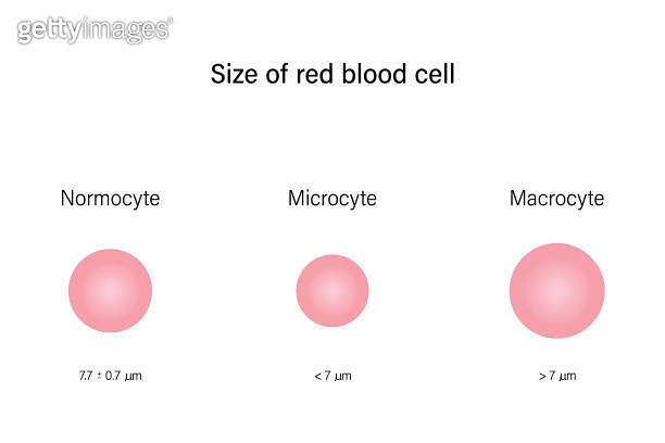Red blood cell morphology. Size of red blood cell. Anisocytosis ...