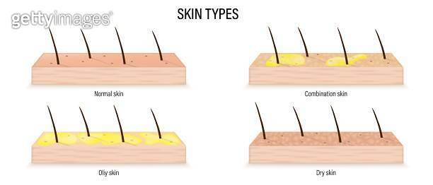 Skin types vector. Different types of skin problems. Normal ...