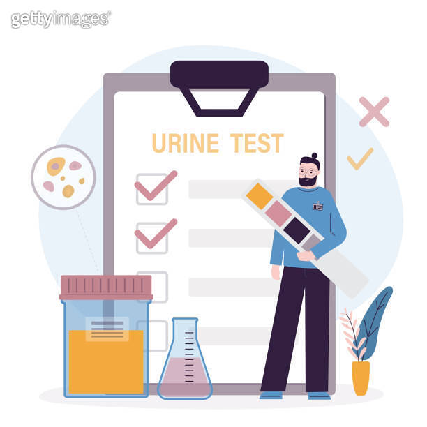 Urine analysis. Laboratory worker conduct research and tests with pee ...