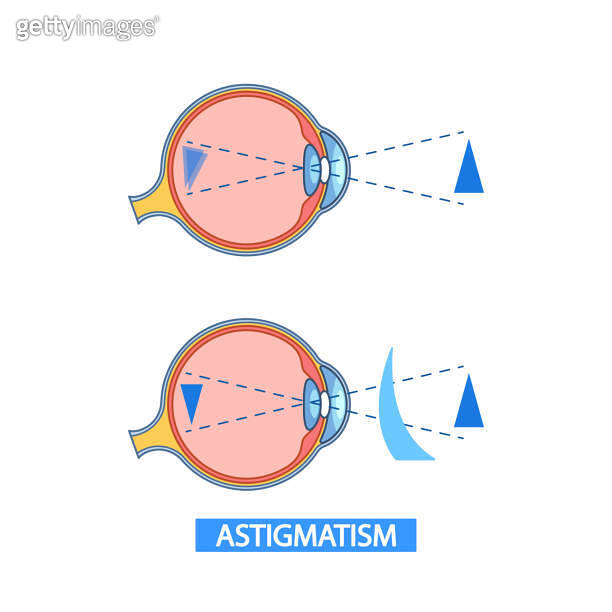 Detailed Infographic Illustrating The Anatomy Of An Eye With ...