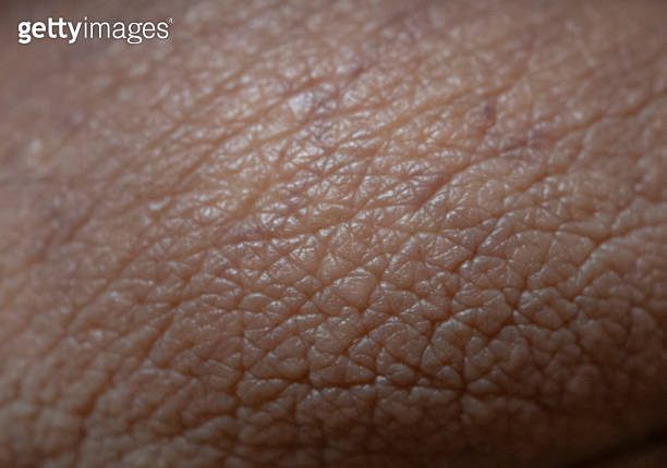 Human skin folds 이미지 (2151436926) - 게티이미지뱅크