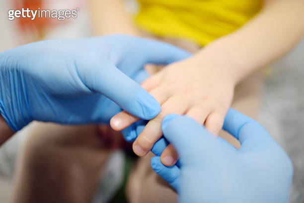 Little boy is at an appointment with a doctor traumatologist with an ...