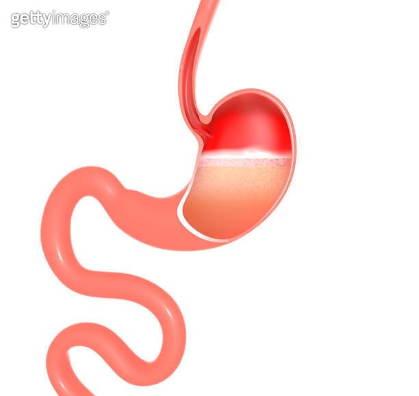 Anatomical 3D illustration of the inside of the stomach doing digestion ...