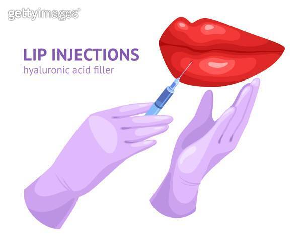 Lip injection. Lips fillers injectables, botox syringe injecting needle ...