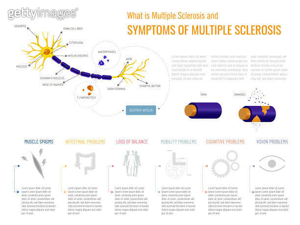 Detailed Infographic on Multiple Sclerosis and its Symptoms.Educational ...