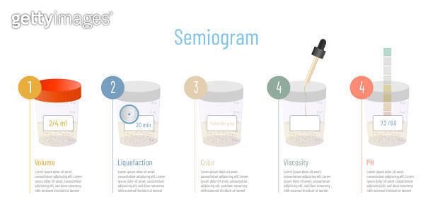 Seminogram consists of studying the semen (2095936573) - 게티이미지뱅크