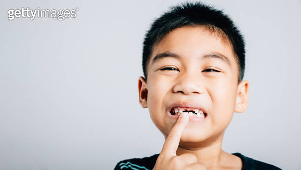Preschooler wide grin shows growing molar gap signifying child dental ...