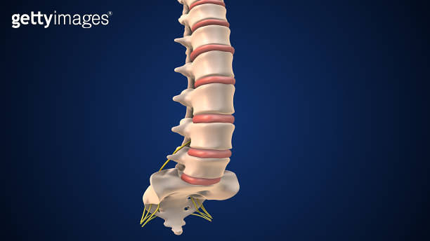 Medical animation of a herniated disc in the lumbar spine (2044301819 ...