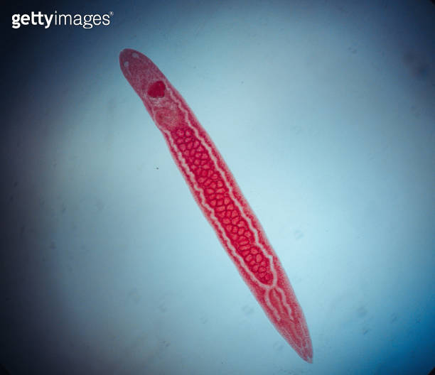 Trematode parasite under a microscope 이미지 (2012211172) - 게티이미지뱅크
