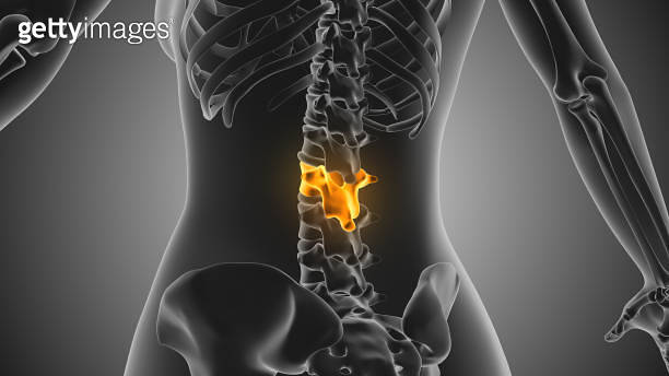 Medical animation of lumbar spine bones and back pain 이미지 (2163348664 ...