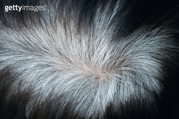 Back view of young people premature gray hair, showing black hoary hair ...