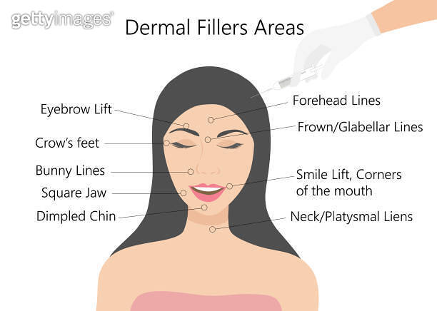 Dermal filler and botox injections areas. Woman face with doctor hands ...