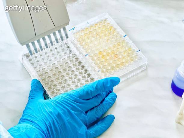 Enzyme-linked immunosorbent assay (ELISA) 96 well micro plate ...