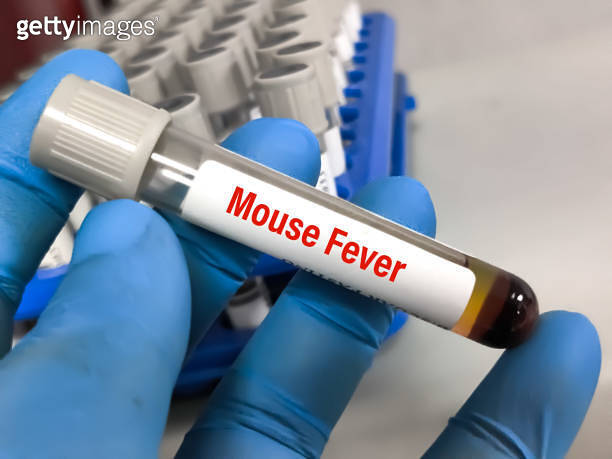 Blood sample for Mouse Fever test. It's also known as streptobacillary ...