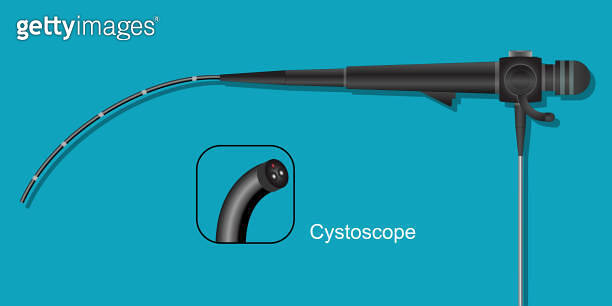 Cystoscope is a hollow tube equipped. 이미지 (2157020898) - 게티이미지뱅크