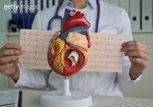 Doctor Holding Anatomical Heart Model and EKG Printout in Office ...